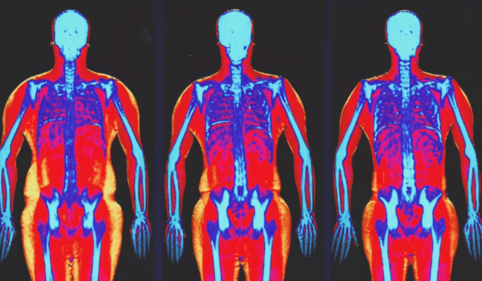 What Does a DEXA Scan Tell You? - Lift Inner West